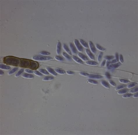 Aureobasidium Spores