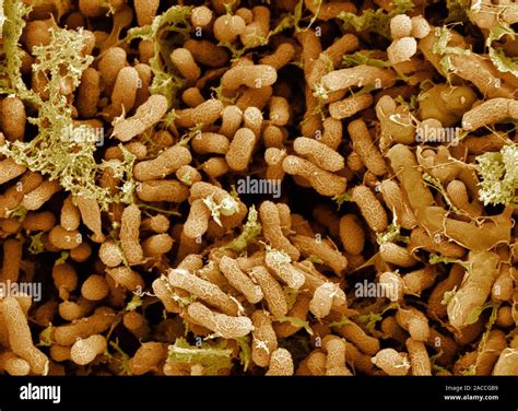Rhizobium Nitrogen Fixing Bacteria Coloured Scanning Electron Micrograph SEM Of Nitrogen