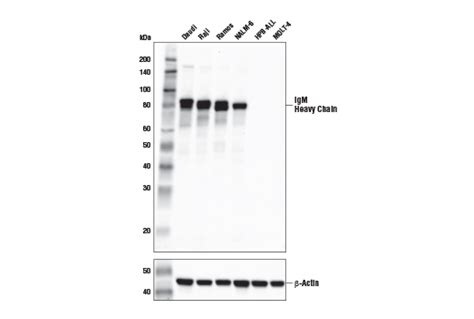 Trbc1 Tcrβ Constant Region 1 Antibody Cell Signaling Technology