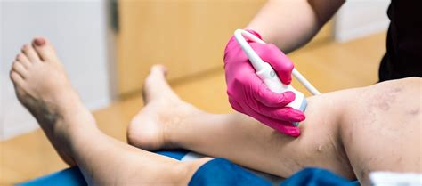 Atherectomy Stridecare