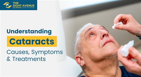 Understanding Cataracts Causes Symptoms And Treatments