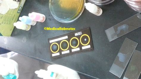 Vibrio Cholerae Serotyping Introduction Principle Test Requireme