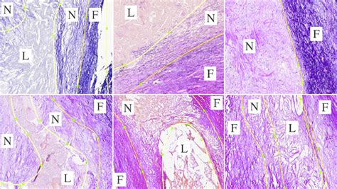 Examples Of Histology Sections And Manual Segmentations That Show The Download Scientific