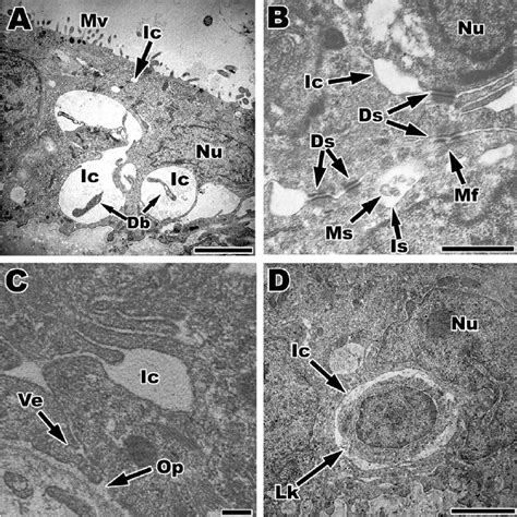 Electron Micrographs Of The Active Rete Testis A Widened
