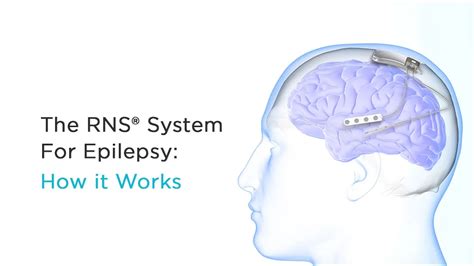 Press Kit Rns System