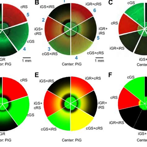 Various Spatial Patterns Directed By Nisin Producing Bacteria Ac