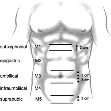 Classification Of Primary And Incisional Abdominal Wall Hernias