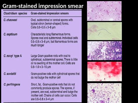 Clostridium Ppt For Undergraduate Class Pptx