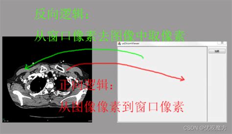 连载：徒手写一个dicom阅图软件（003）之图像坐标系转换dicom 坐标系 Csdn博客