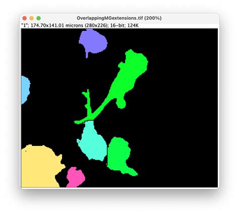 Microglia Morphometry Can I Segment Overlappingintersecting