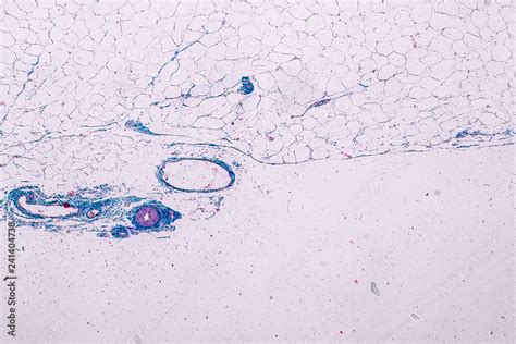 Adipose Tissuebody Fatsimply Fat Is A Loose Connective Tissue Under
