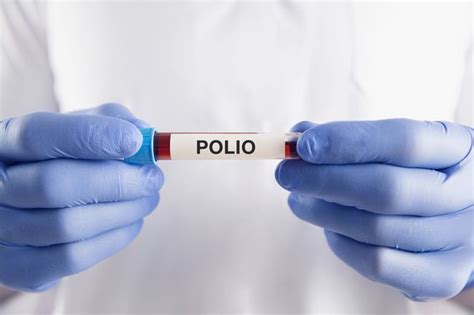 Apakah Polio Bisa Disembuhkan And Ada Obatnya
