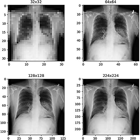 Is Radiology Different From Radiography At Bobby Holman Blog