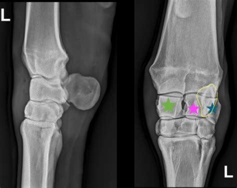 Quiz 3 Proximal Limb Flashcards Quizlet