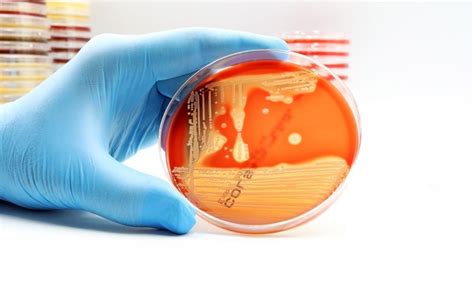 A Step Forward In The Battle Against Methicillin Resistant