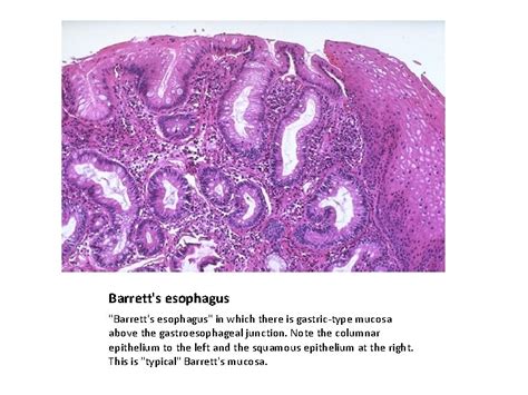 Gi Lab 1 Esophagus And Stomach Normal Esophagus