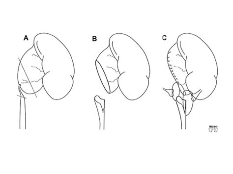 Dorsal Lumbotomy Ppt