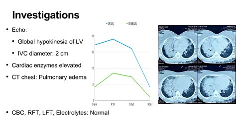 Allergy Induced Myocardial Infarction Kounis Syndrome Coronary Hypersensitivity Disorder