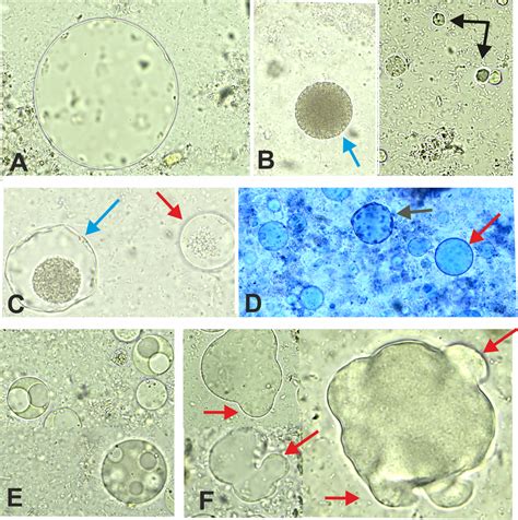 Observation Under The Light Microscope ×400 Of Different Forms Of