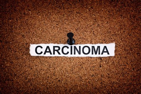 Signs And Symptoms Of Squamous Cell Carcinoma Skin And Cancer Institute
