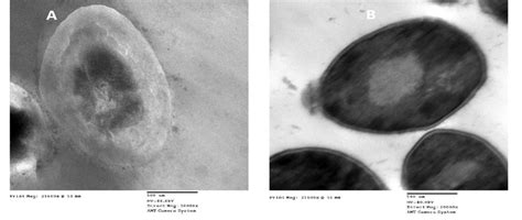 Scan And Transmission Electron Microscope Of Staphylococcus Aureus Test