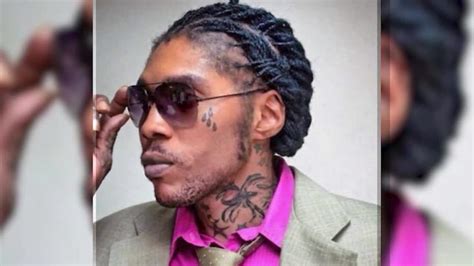What Happened To Vybz Kartels Face Fans Question Dancehall Stars