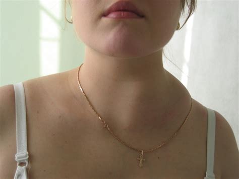 Какви заболявания издават възпалени лимфни възли Здраве Ws