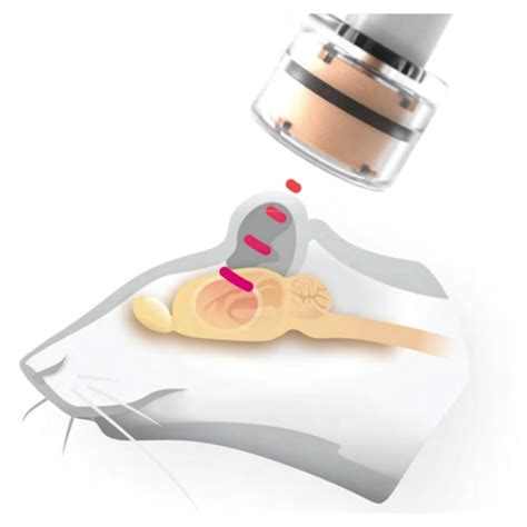 Miniature Rtms Coil For Rodents