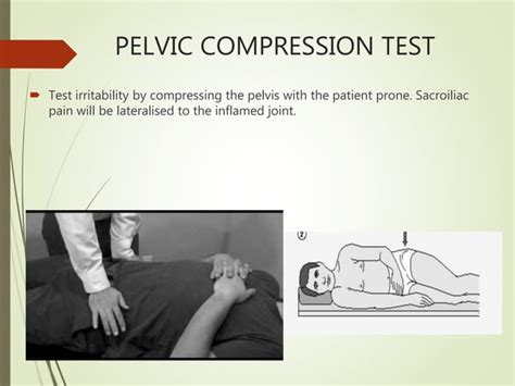 Ankylosing Spondylitis Physiotherapy Ppt Pptx