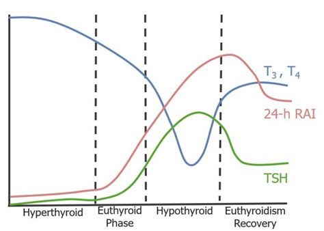 Thyroiditis Concise Medical Knowledge