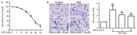 Carvedilol Inhibits Proliferative And Invasive Abilities Of Hepatic