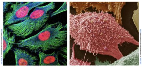 L07 Cell Signalling Cancer Flashcards Quizlet