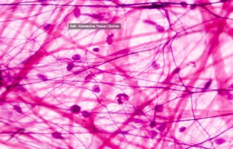 Connective Tissue Flashcards Quizlet