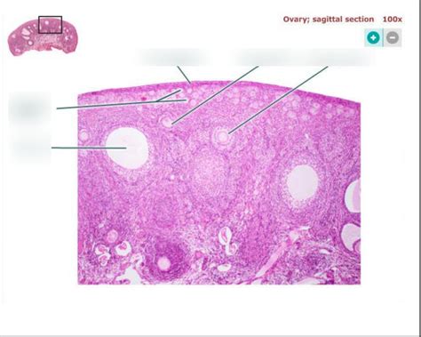 Ovary Diagram Quizlet