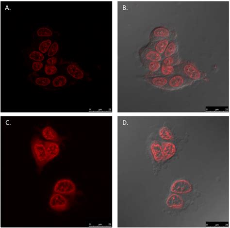 Development Of Multi Layered And Multi Sensitive Polymeric Nanocontainers For Cancer Therapy In