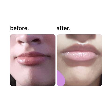 Lip Subliminal Results R Subliminal