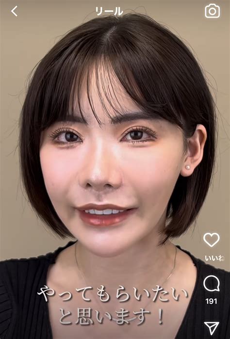 二重整形の名医相談🏥目頭切開、眉下切開、埋没法、二重切開、全切開、眼瞼下垂、目尻切開、鼻フル、涙袋 On Twitter 鼻下切る人は