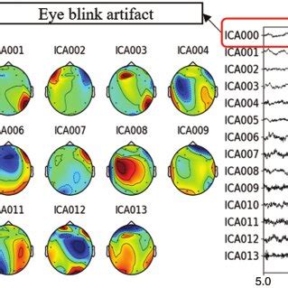 A EEG Channel Layout Used In The Study B Illustration Of The Download Scientific Diagram