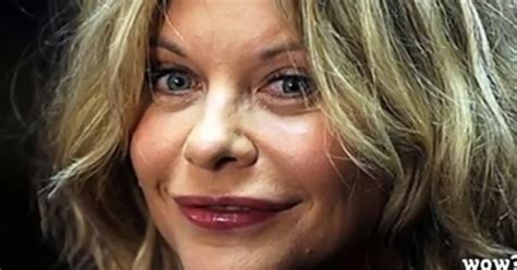 맥 라이언 성형중독 충격 외모에 네티즌 경악