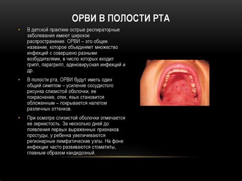 Полость рта Соматические заболевания презентация онлайн