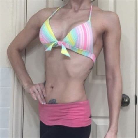 7 Key Advantages And Disadvantages Of Very Large Breast Implants You