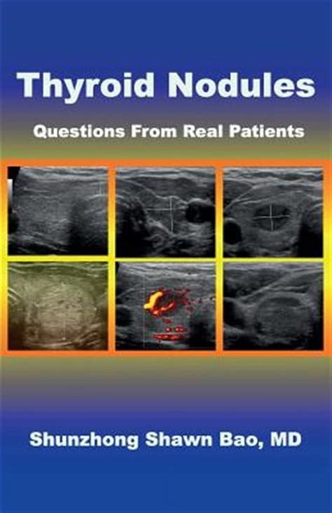 Thyroid Nodules Questions From Real Patients Walmart Business Supplies