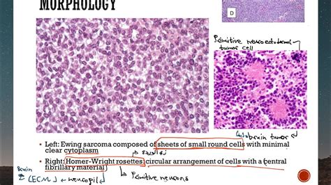 MSS Pathology Lecture 5 YouTube