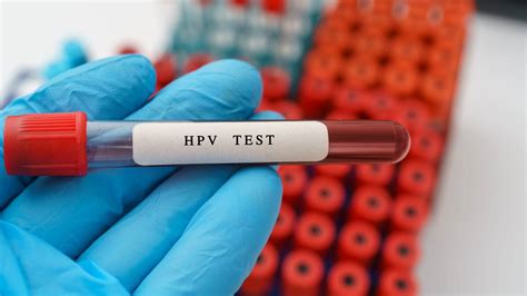 Cms Designates Hpv Test As An Advanced Diagnostic Lab Test Clinical Lab Products