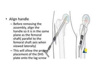 Dynamic Hip Screw Pptx