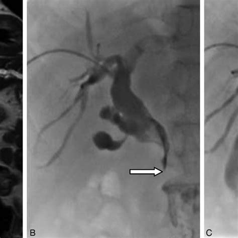 The Preoperative Imaging Examinations And Intraoperative Download