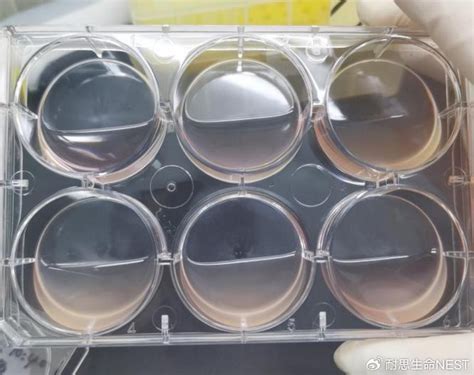 手把手教学——trizol提取细胞rna的经验分享 知乎