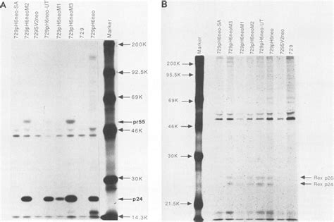 Immunoprecipitation Of 35s Methionine Cysteine Labeled Stable