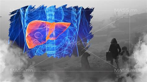 Манай улсад сайжруулсан шахмал түлшнээс ялгардаг хүхрийн ислээс болж шинэ төрлийн мутаци буюу