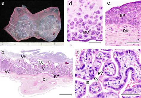 Figure 5 From Histology Of Human Placenta Semantic Sc
